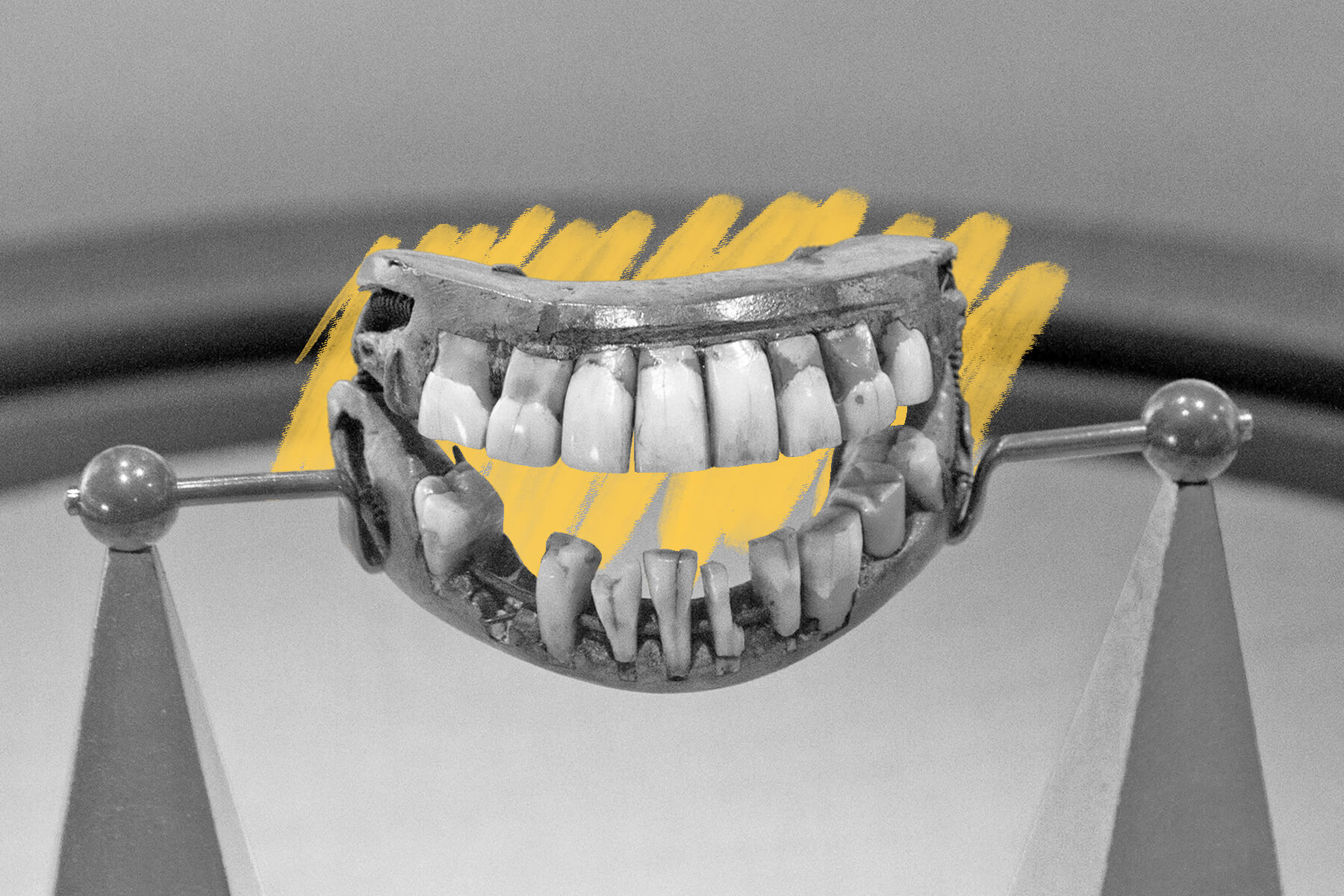 George Washington's dentures were made from, among other things, hippo ...